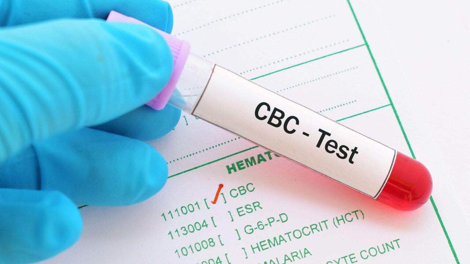 CBC VS CBP Test | Difference, Price & Details - CBC Test Lucknow